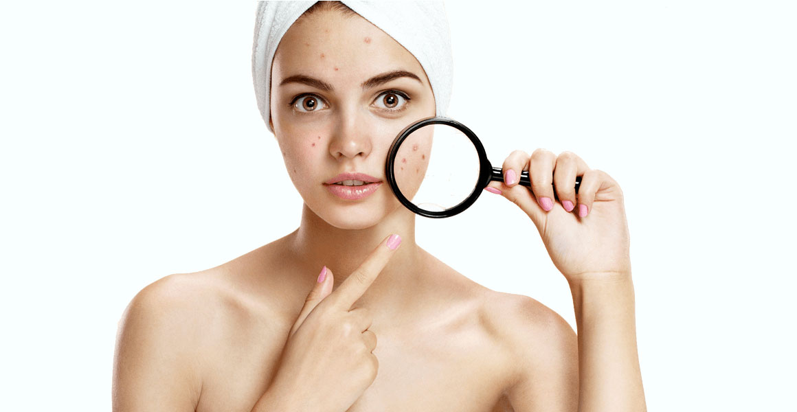 WIE WIRD MAN PICKEL LOS - EPIDERMA®